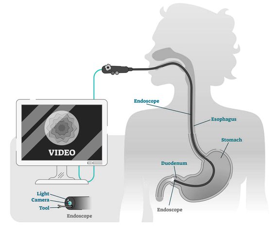 Endoscopy Services | Larkin Health